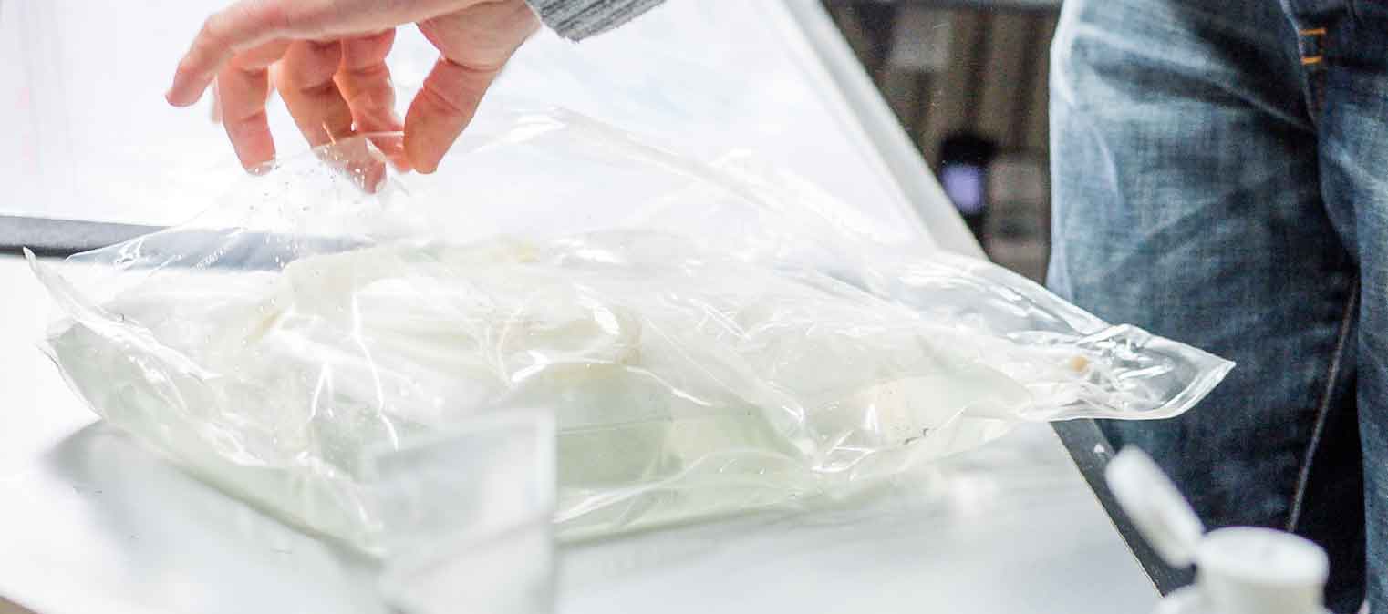 Peritonealdialyse im Detail - Nephrologisches Zentrum