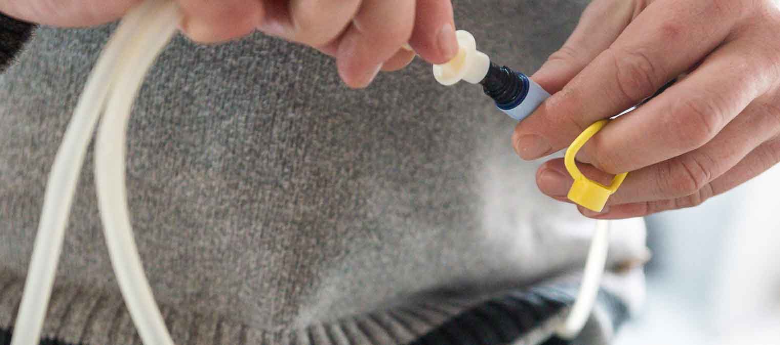 Peritonealdialyse im Detail - Nephrologisches Zentrum